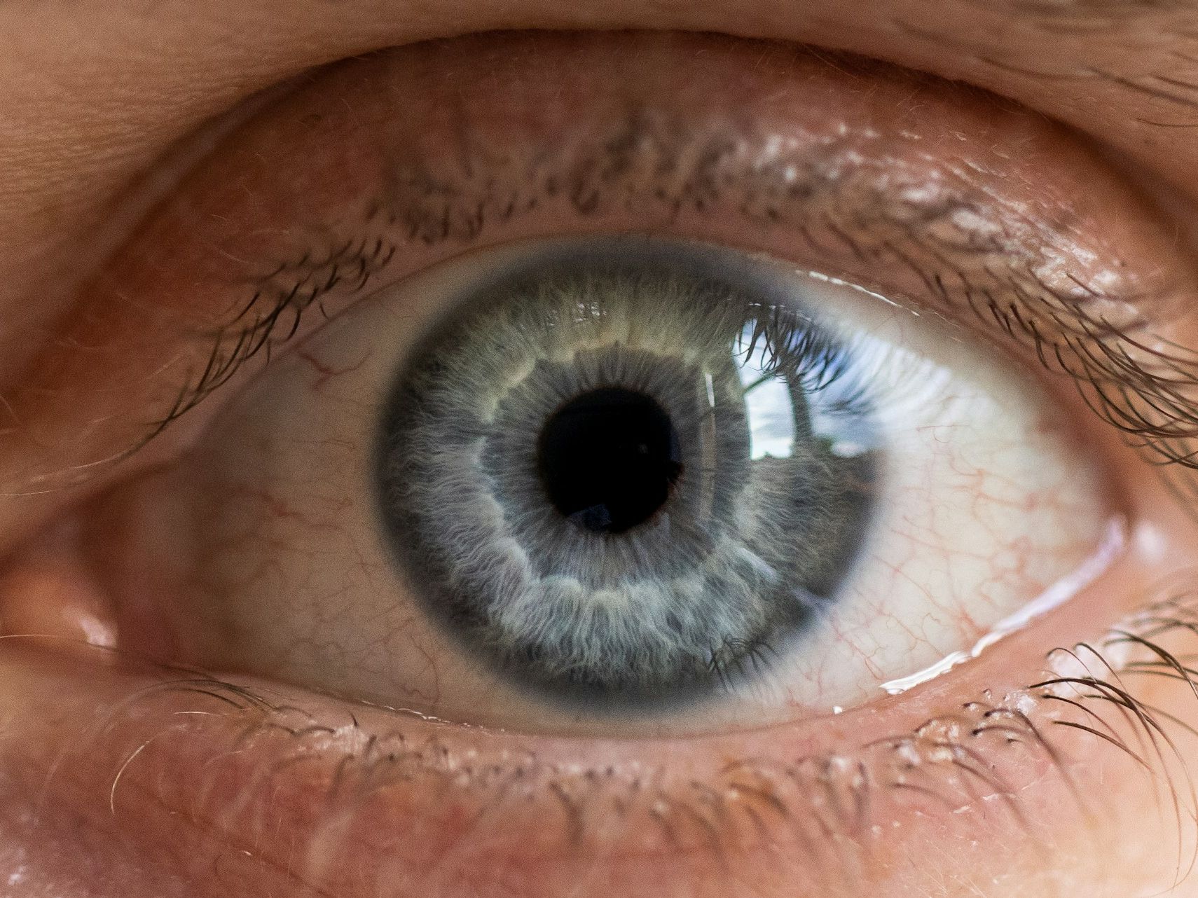 Refractive Lens Exchange in Mexico: Affordable Costs | MedicalTourism ...