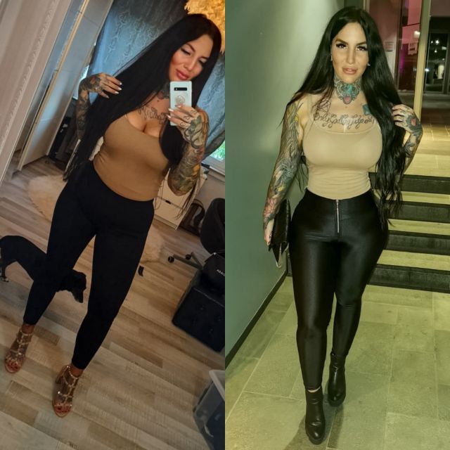 Patient Story: Brazilian Butt Lift Before and After | MedicalTourism.Review